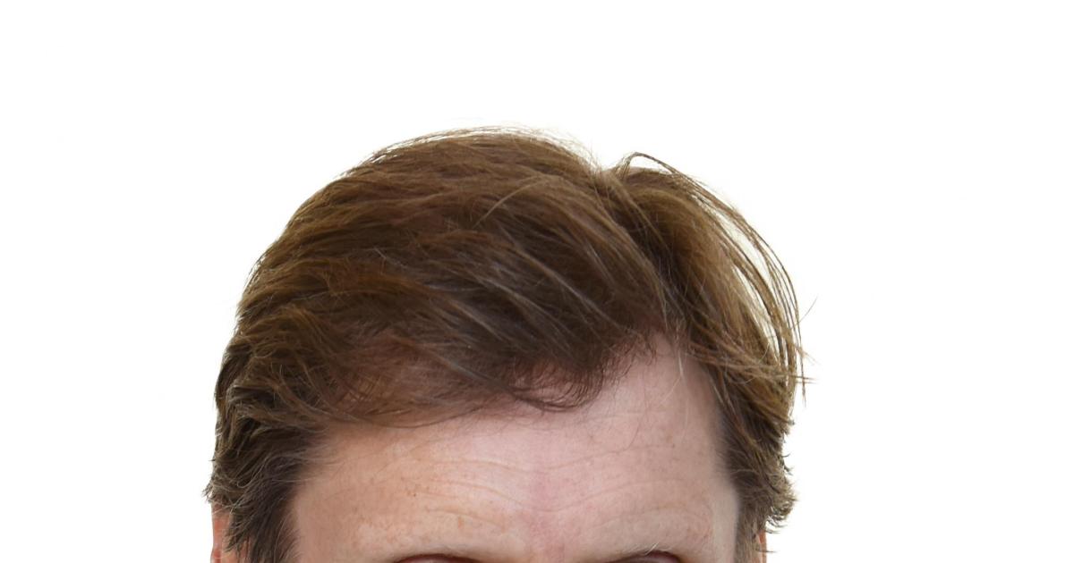 dhr. dr. R.J. Hillen | Dijklander Ziekenhuis